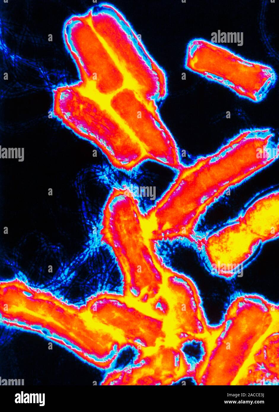 Salmonella. Coloured transmission electron micro- graph (TEM) of a ...