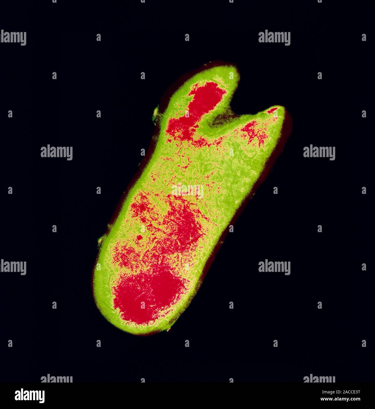 Mycobacterium tuberculosis. Transmission electron micrograph (TEM) of a ...