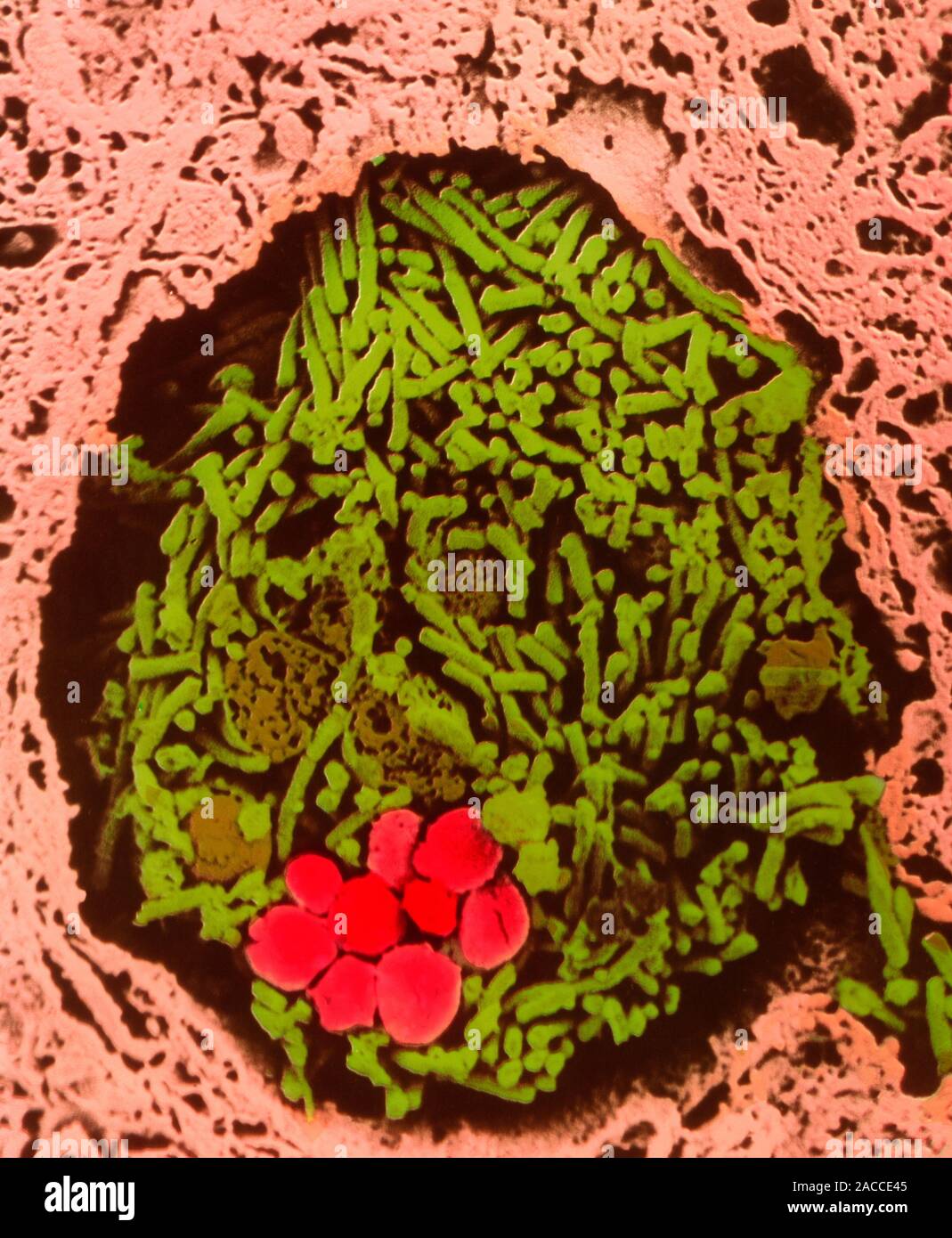 Coloured scanning electron micrograph of a cluster of anthrax bacteria ...