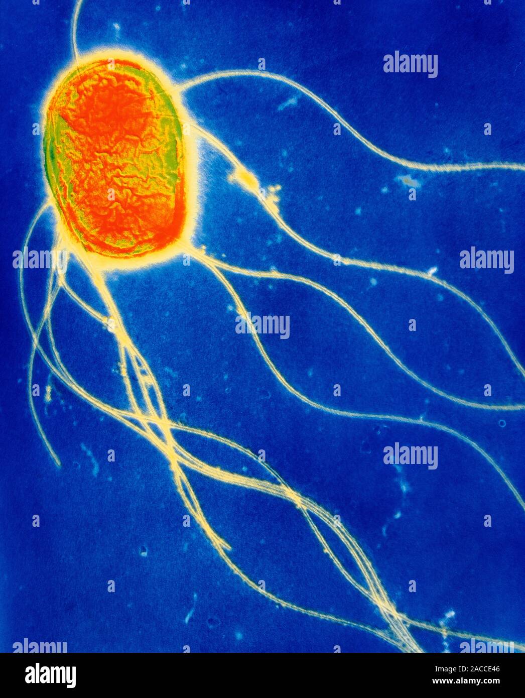 Salmonella. Coloured transmission electron micrograph of a Salmonella ...