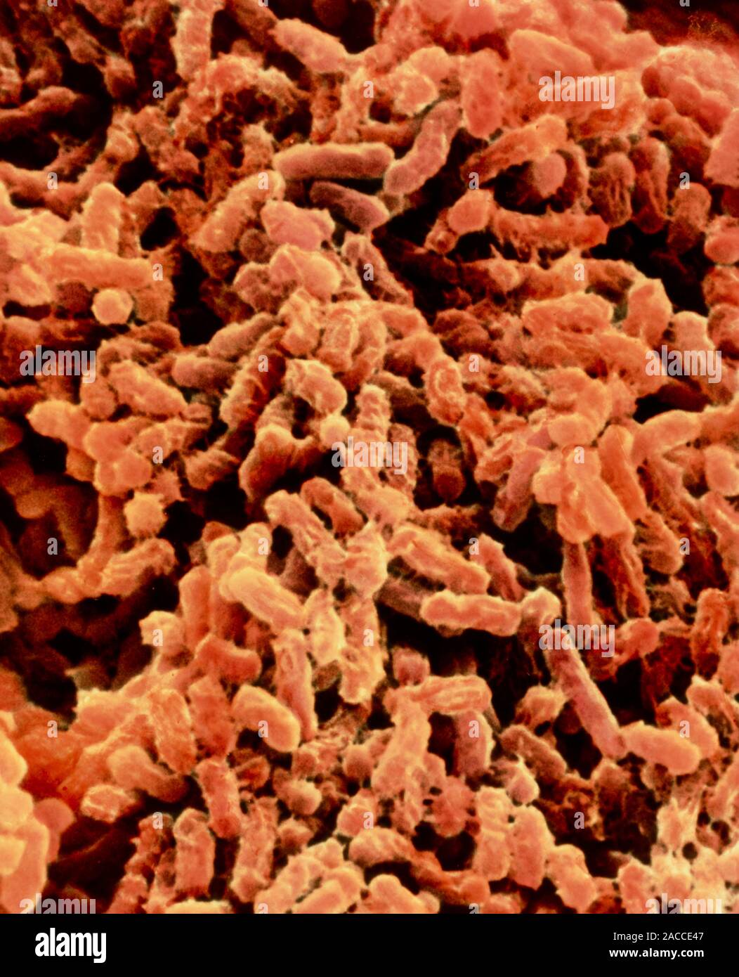 Coloured scanning electron micrograph of the bacterium Klebsiella ...
