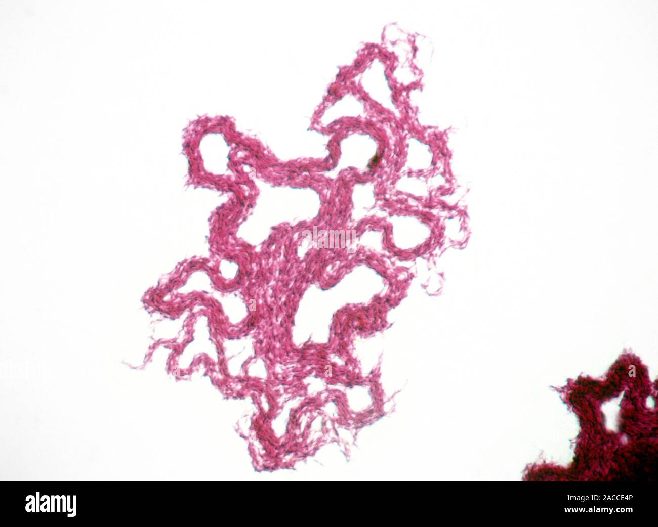 Mycobacterium tuberculosis. Light micrograph of a colony of the ...