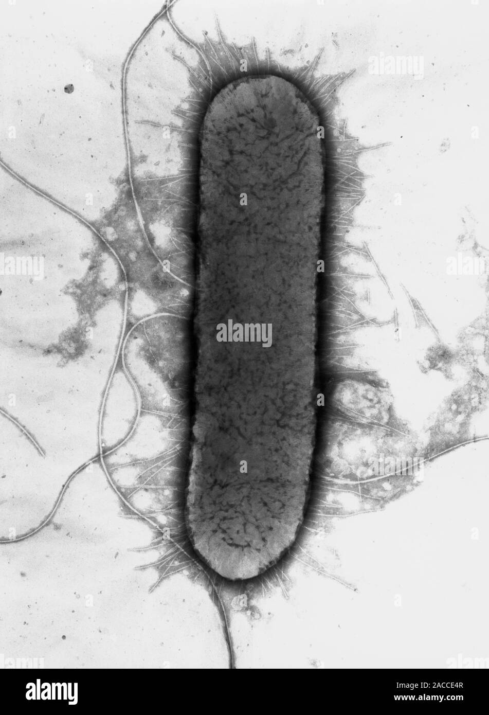 Erwinnia chrysanthemi. Transmission Electron Micrograph (TEM) of a ...