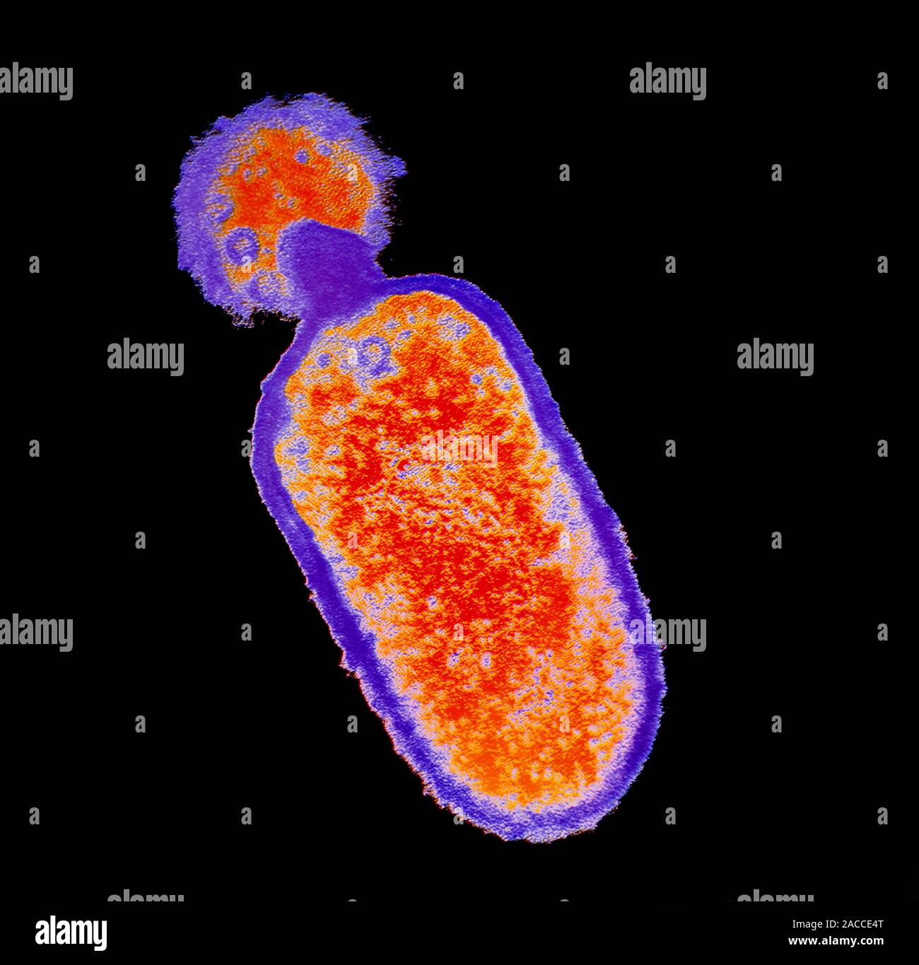 Listeria monocytogenes. Coloured transmission electron micrograph of ...