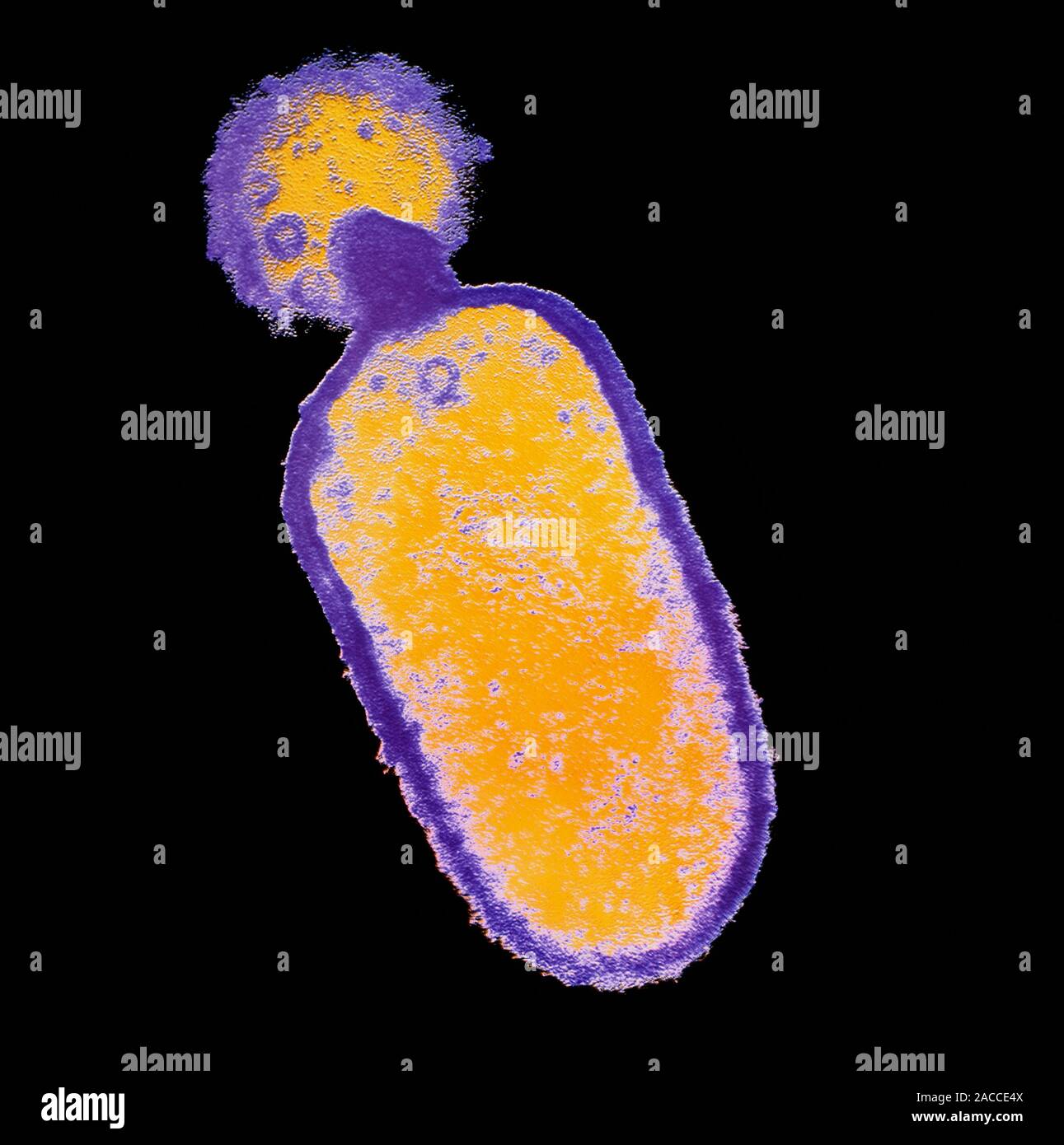 Listeria monocytogenes. Coloured transmission electron micrograph of ...