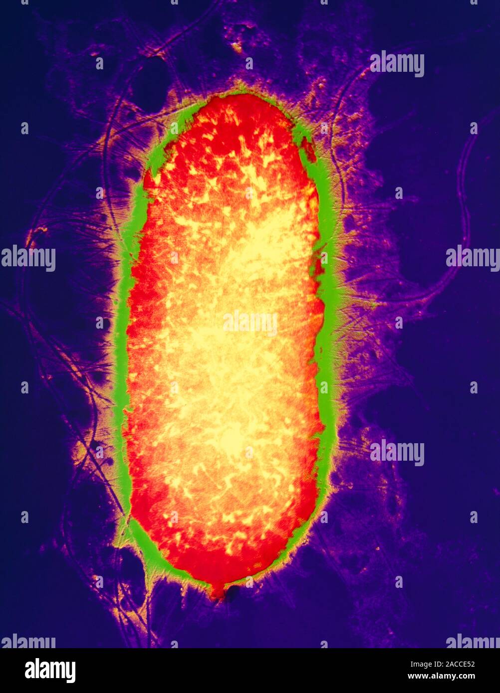 Erwinnia chrysanthemi. Coloured Transmission Electron Micrograph of the ...