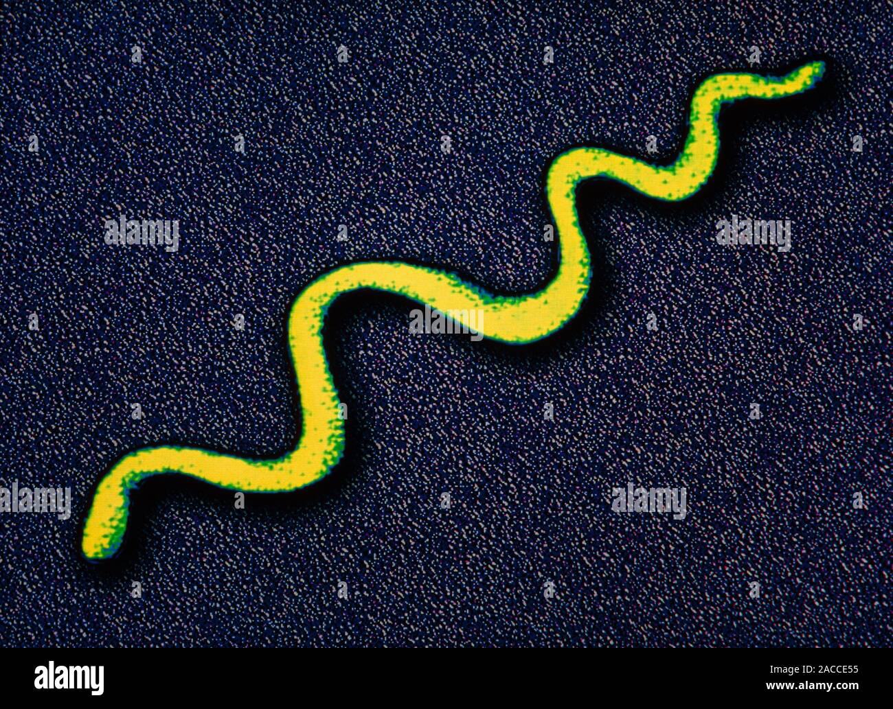 Treponema pallidum. Coloured Transmission Electron Micrograph (TEM ...