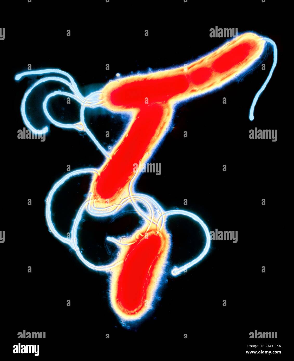 Coloured transmission electron micrograph (TEM) of the bacteria Helicobacter pylori (formerly ...