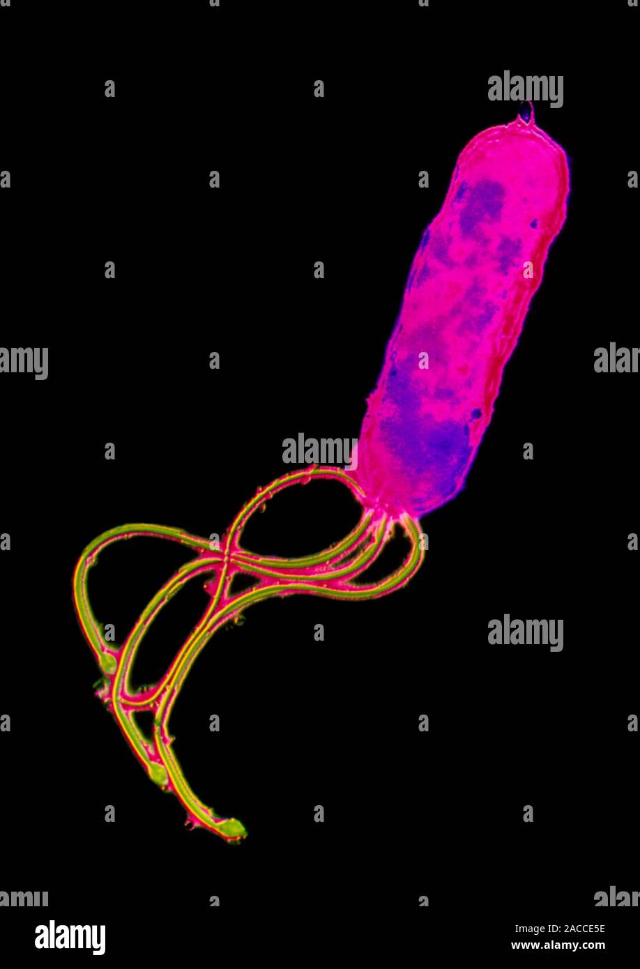 Coloured transmission electron micrograph (TEM) of the bacterium Helicobacter pylori (formerly ...