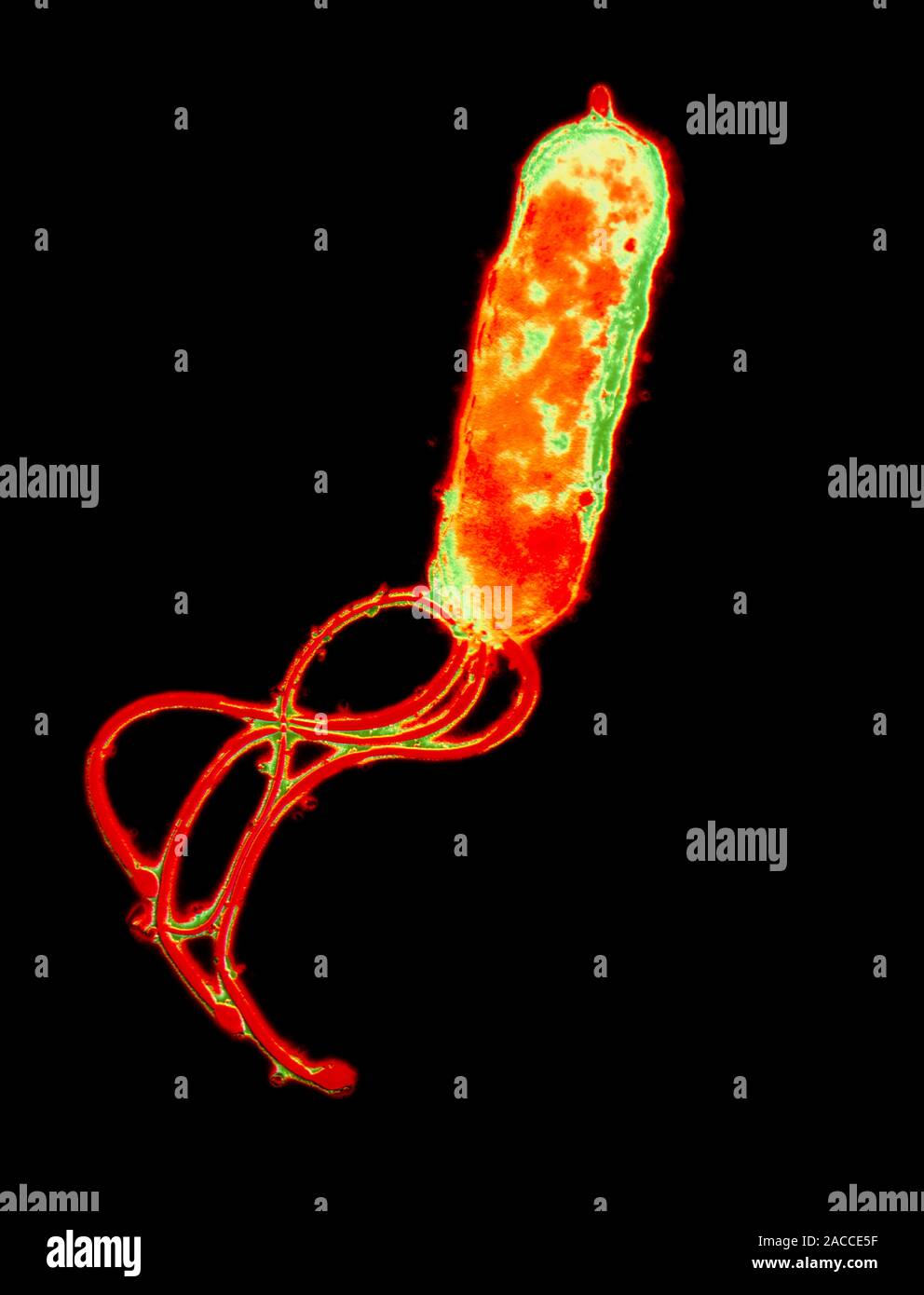 Coloured transmission electron micrograph (TEM) of the bacterium Helicobacter pylori (formerly ...