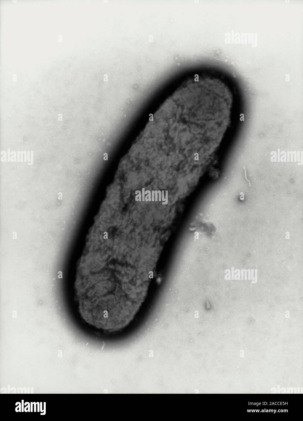Transmission electron micrograph of Yersinia pestis, the bacterium ...