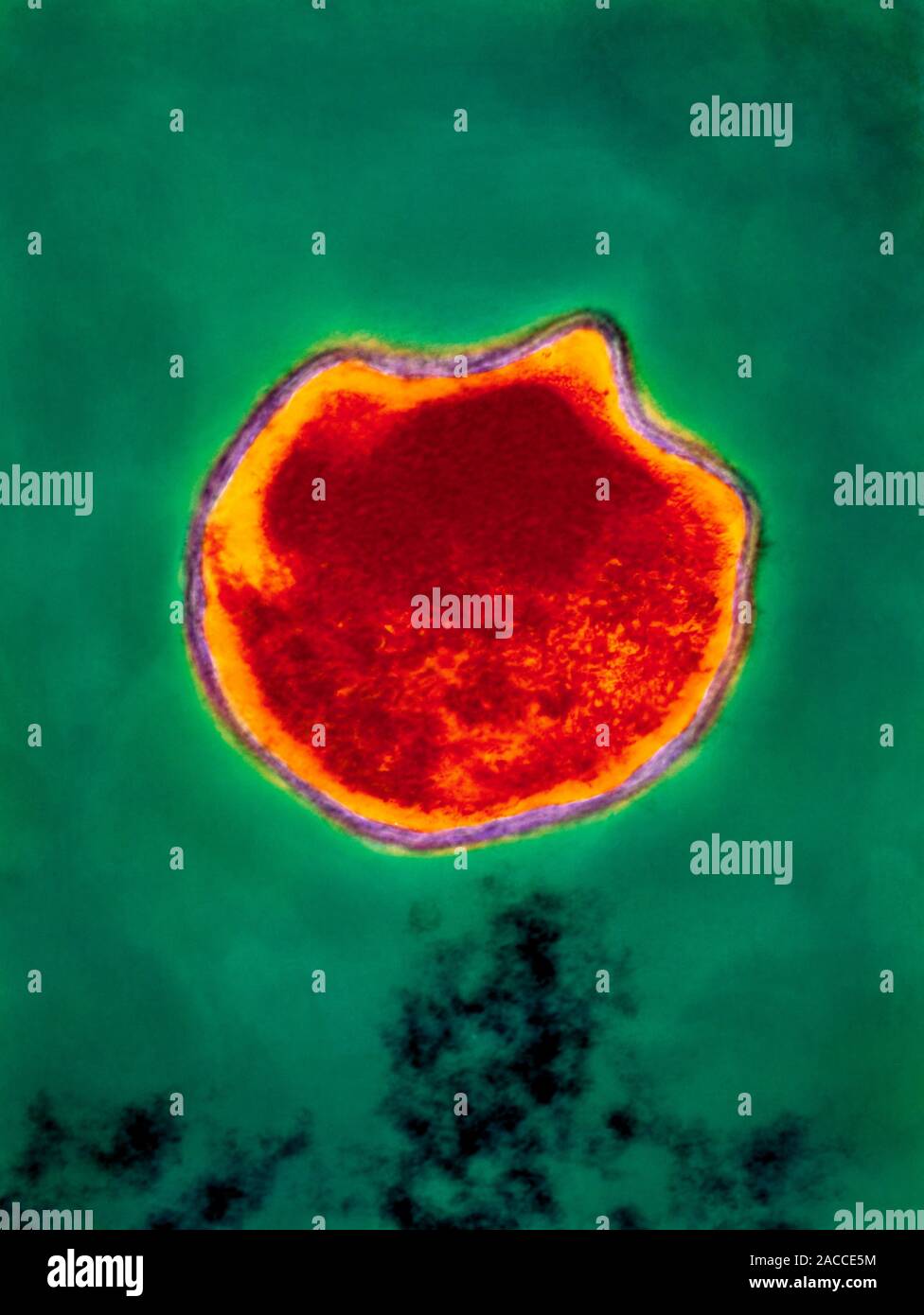 Chlamydia pneumoniae. Coloured transmission electron micrograph of a ...