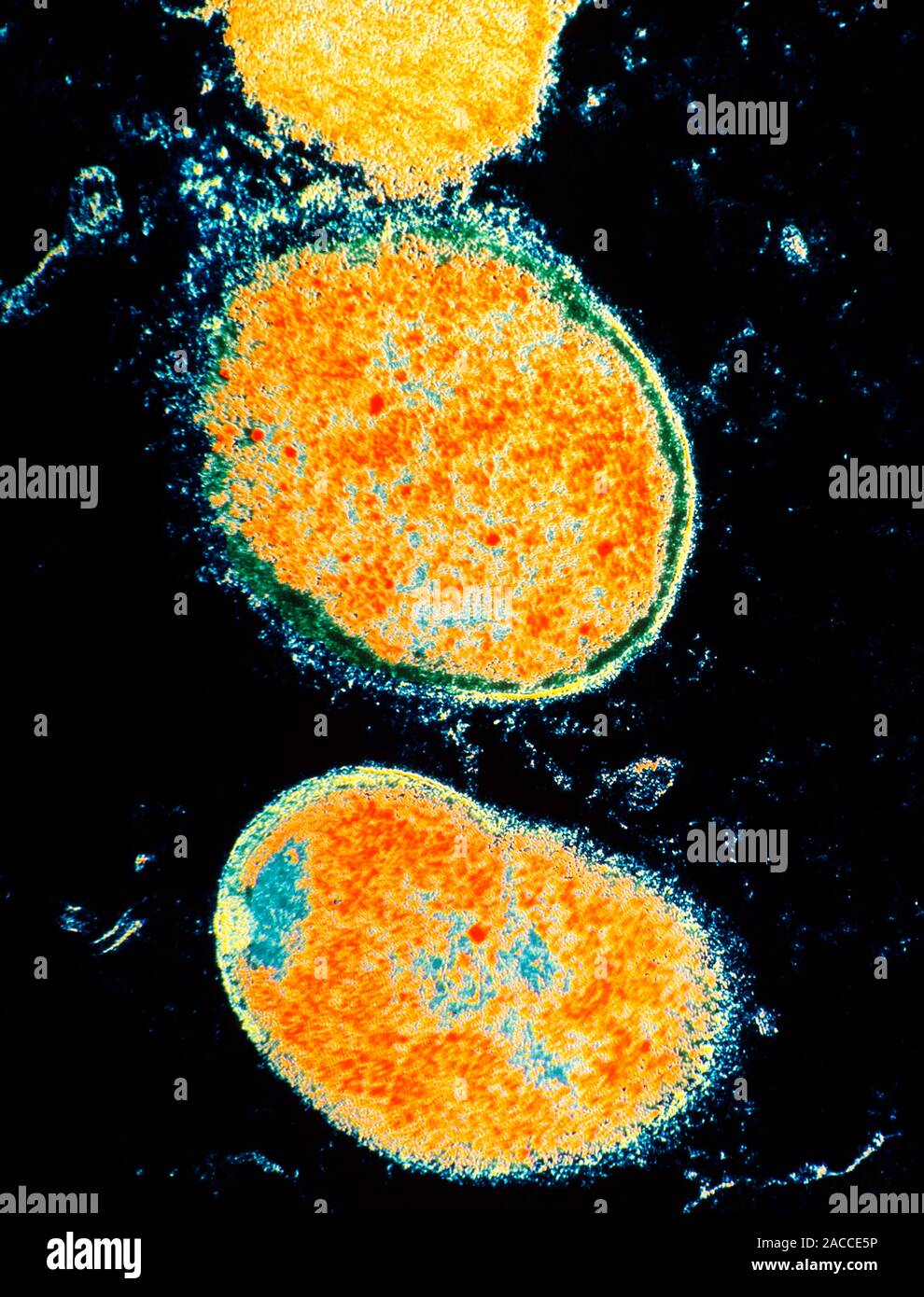 Helicobacter pylori. Coloured transmission electron micrograph of two H. pylori bacteria in ...