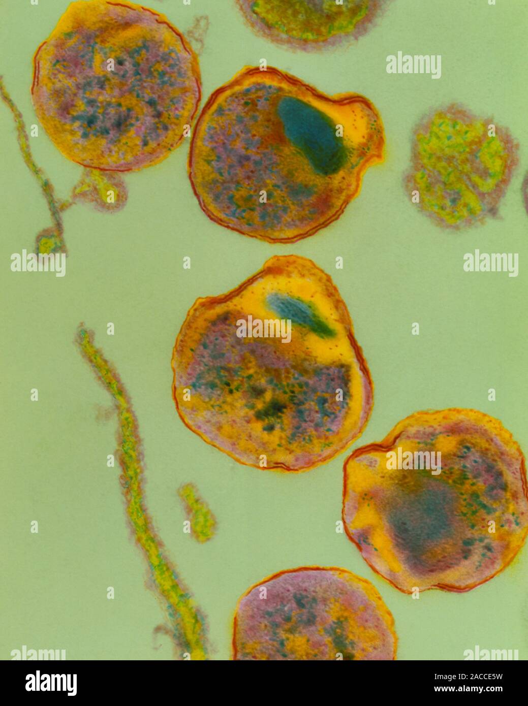 Chlamydia psittaci. Coloured Transmission electron micrograph of the ...