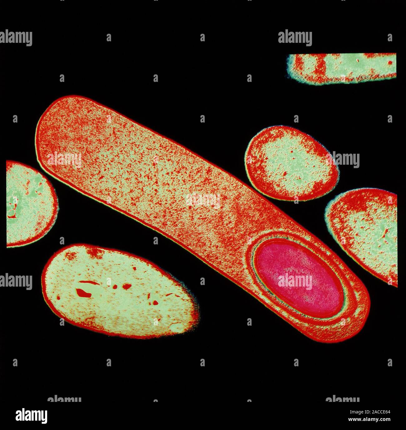 Clostridium difficile. Coloured Transmission electron micrograph of C ...