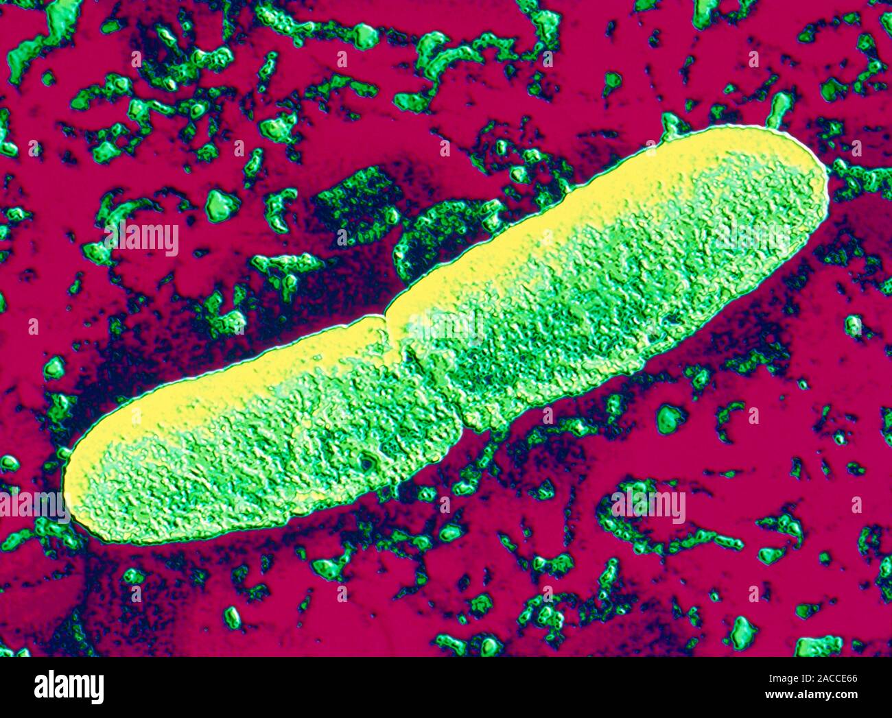 Yersinia pestis. Coloured Transmission Electron Micrograph (TEM) of ...