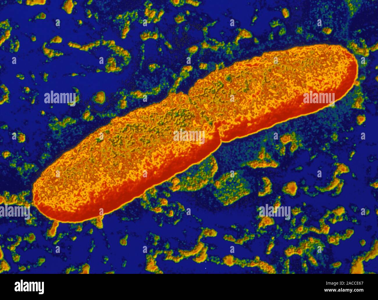 Signs And Symptoms Of Yersinia Pestis at Sandra Mathers blog