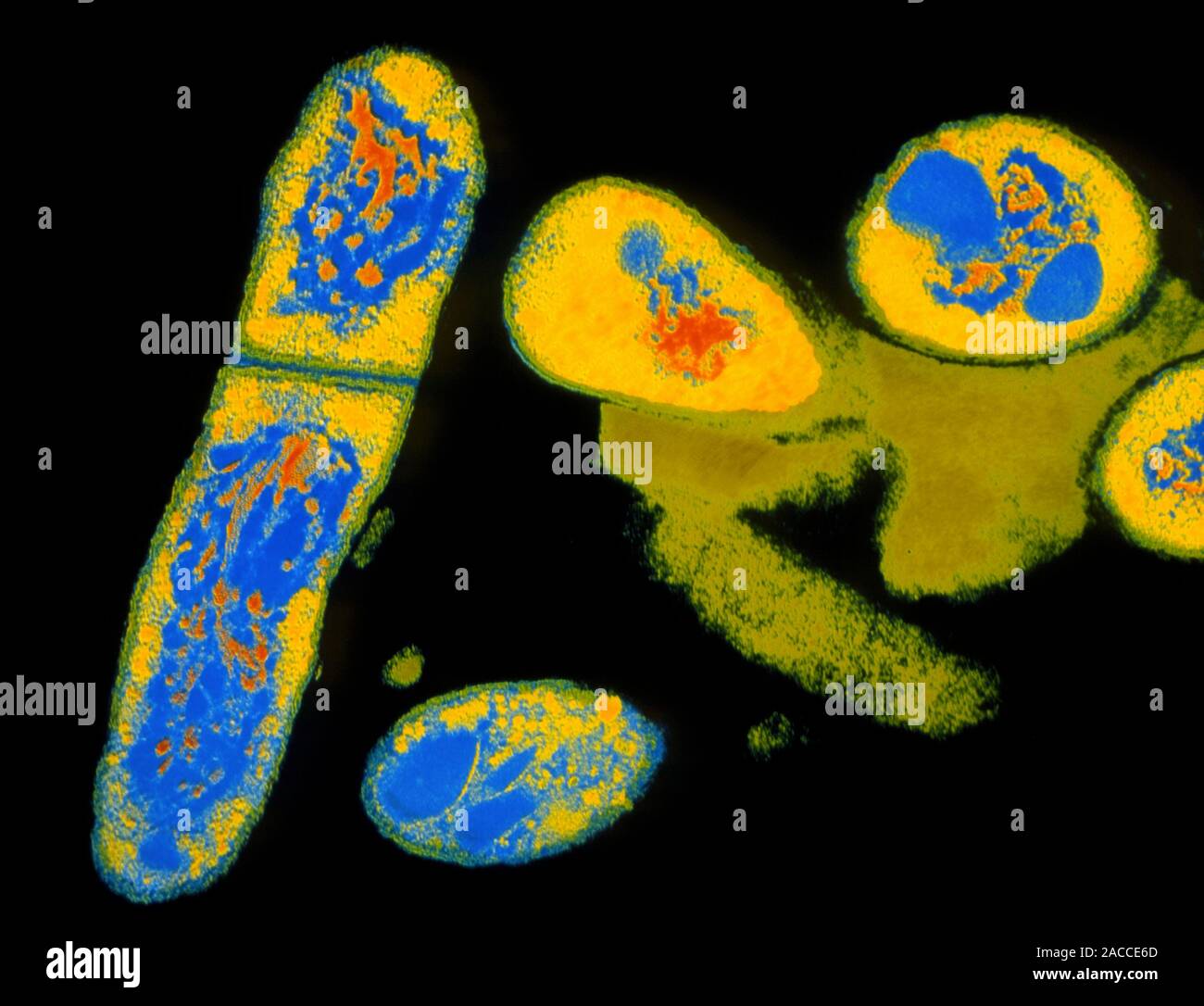 Mycobacterium tuberculosis. Coloured transmission electron micrograph (TEM) of the bacteria ...