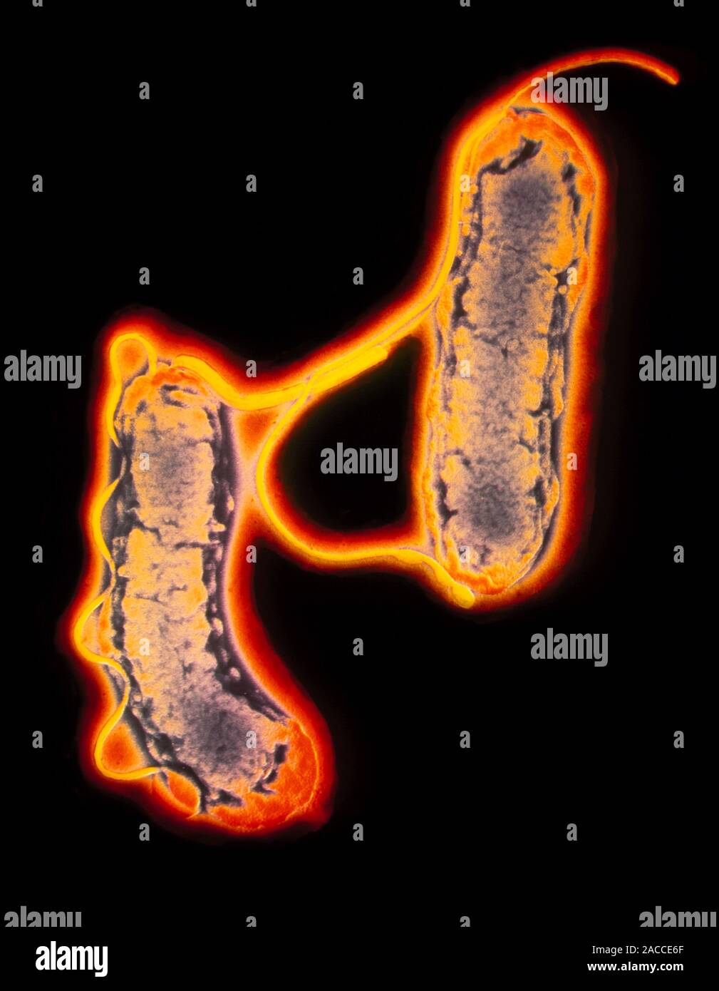 Helicobacter pylori. Coloured transmission electron micrograph of two Helicobacter pylori ...