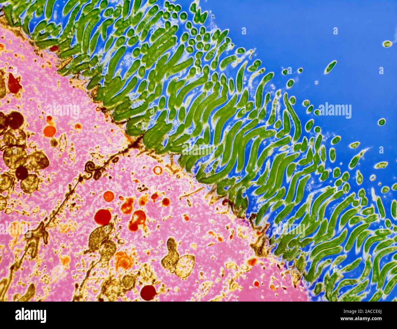 Treponema sp. Coloured transmission electron micrograph of spirochaete ...