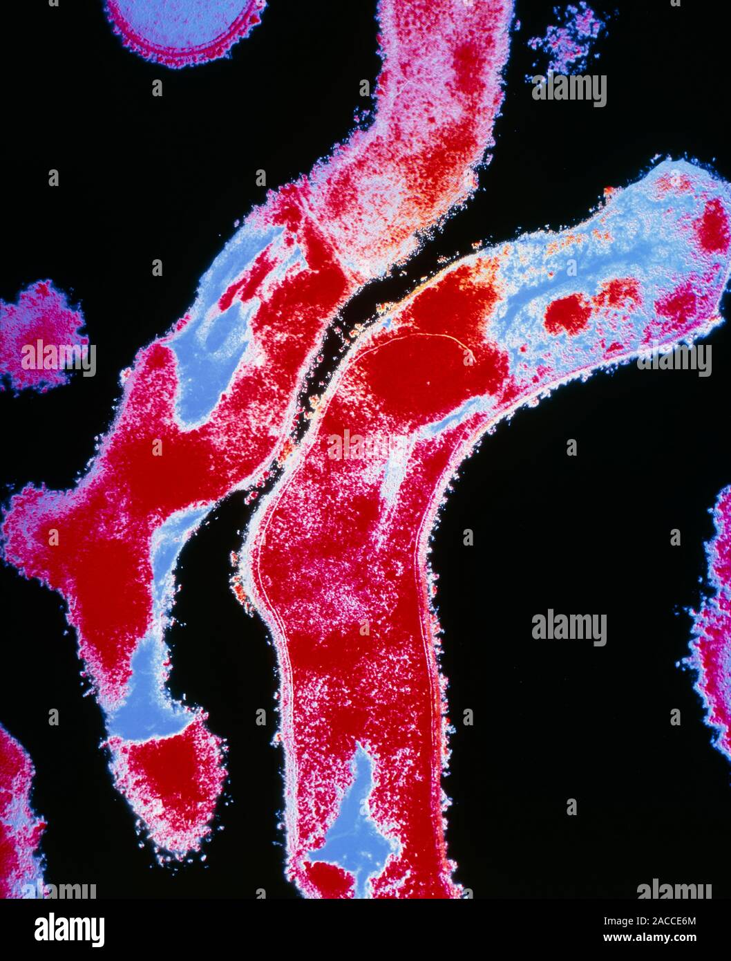 Arcanobacterium haemolyticum. Coloured transmission electron micrograph (TEM) of the Gram ...