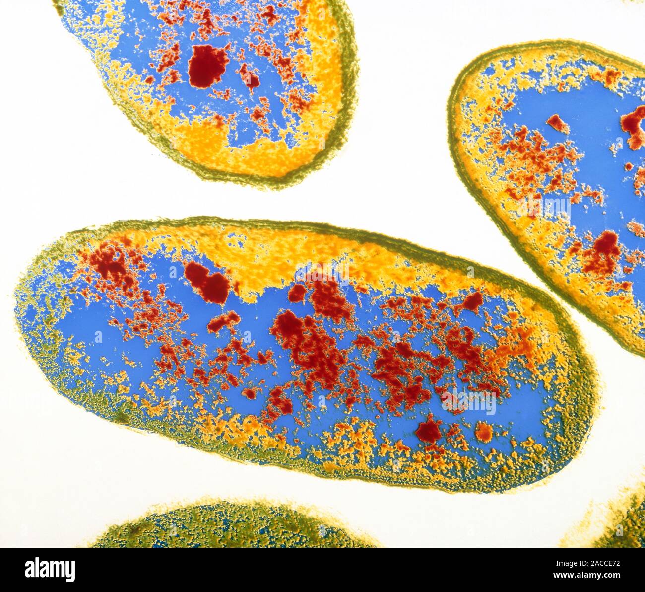 Aeromonas hydrophila. Coloured transmission electron micrograph of thin ... Aeromonas hydrophila. Coloured transmission electron micrograph of thin ...