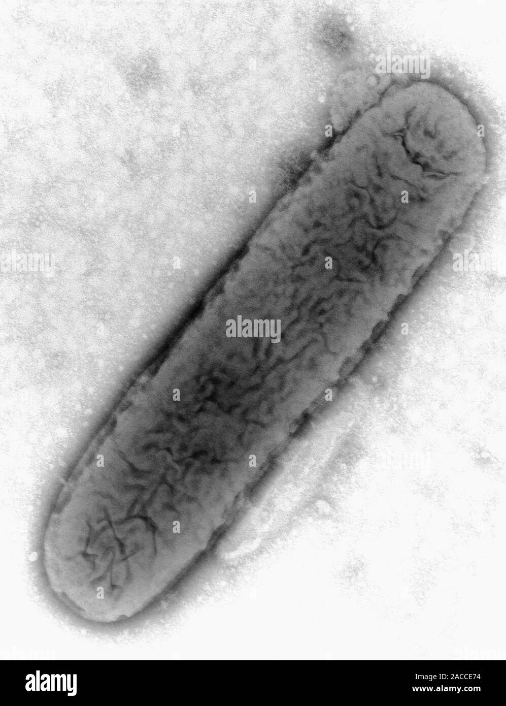 Eikenella corrodens. Transmission electron micrograph of the bacteria ...