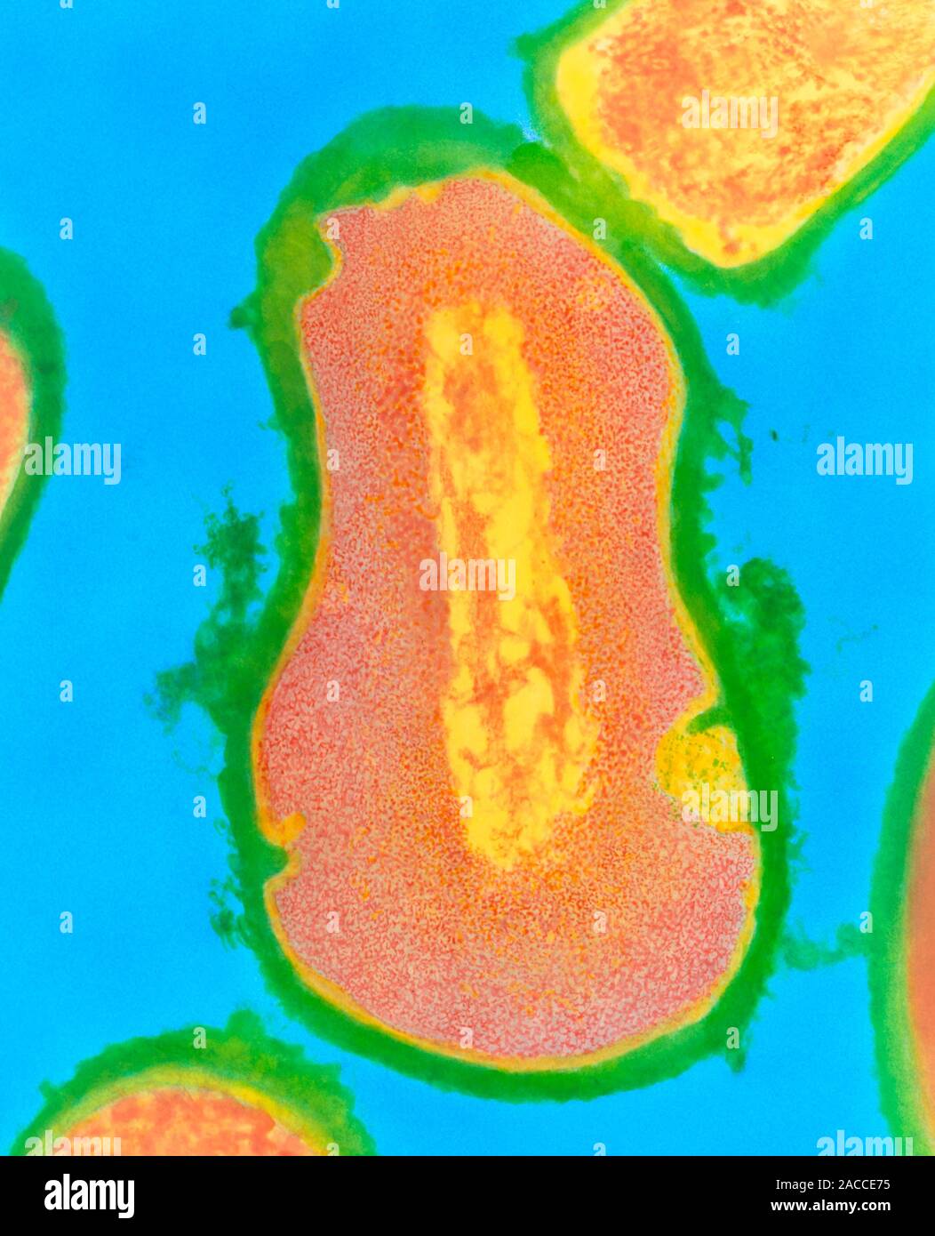 Propionibacterium acnes. Coloured transmission electron micrograph of a ...