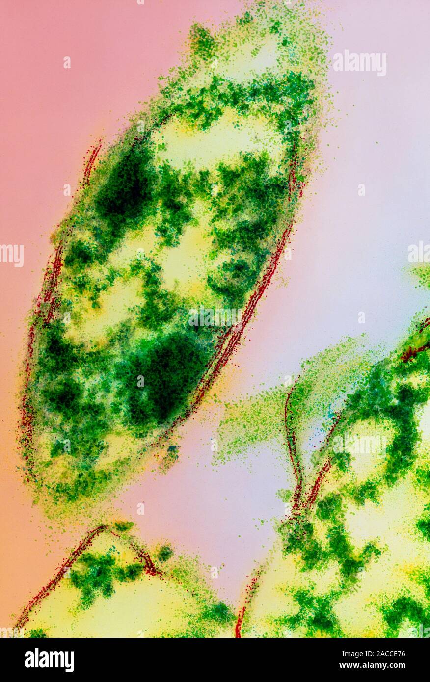 Fusobacterium nucleatum. Coloured transmission electron micrograph of a ...