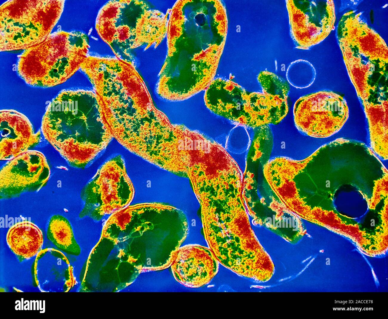Helicobacter pylori. Coloured transmission electron micrograph of Helicobacter pylori bacteria ...