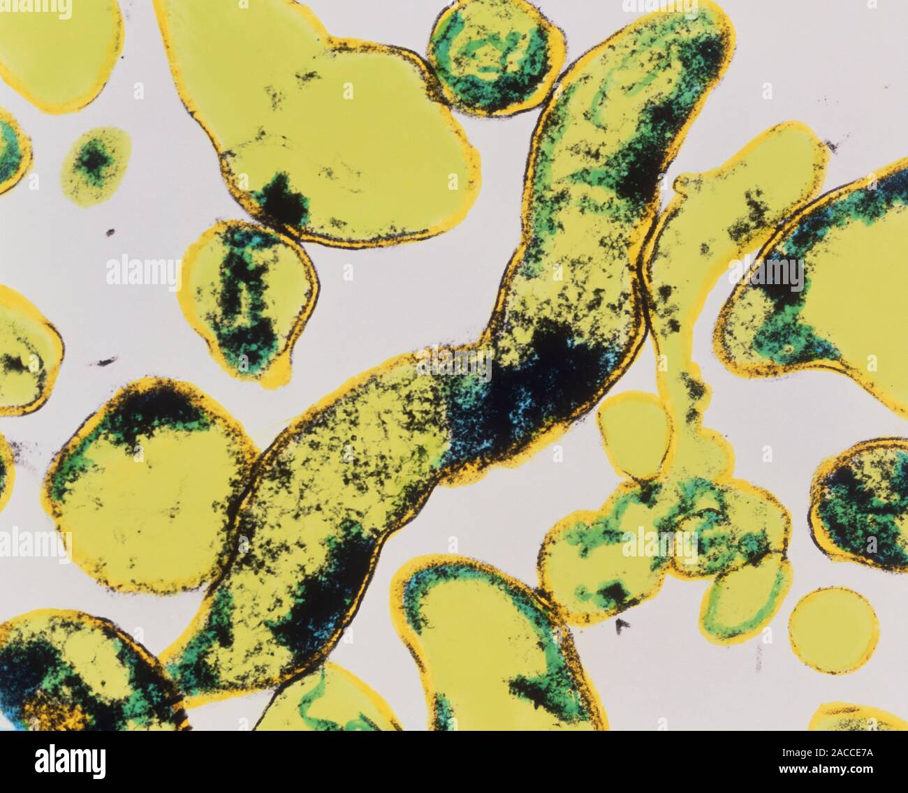 Helicobacter pylori. Coloured transmission electron micrograph of Helicobacter pylori bacteria ...
