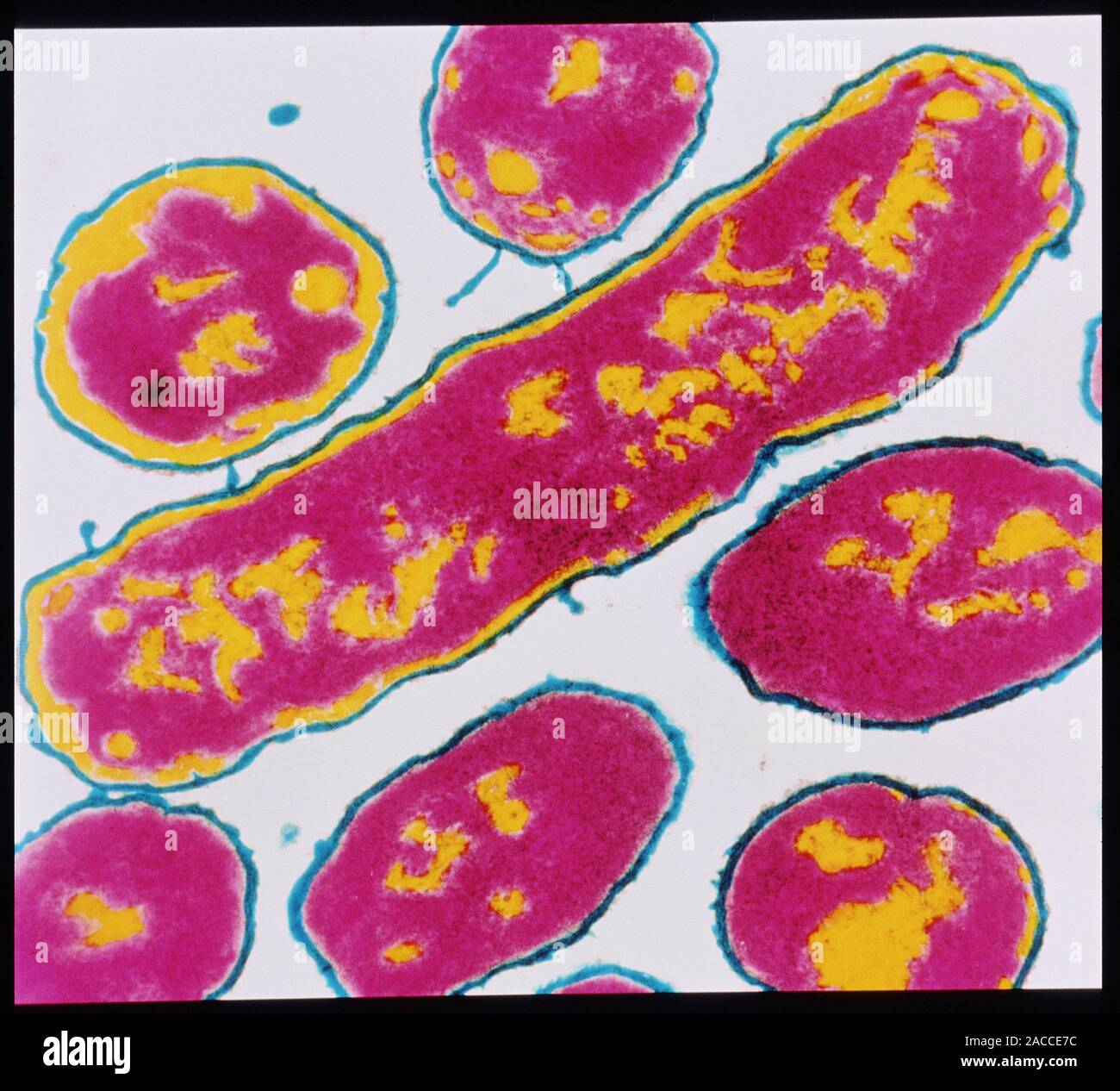 Haemophilus influenzae. Coloured transmission electron micrograph of ...