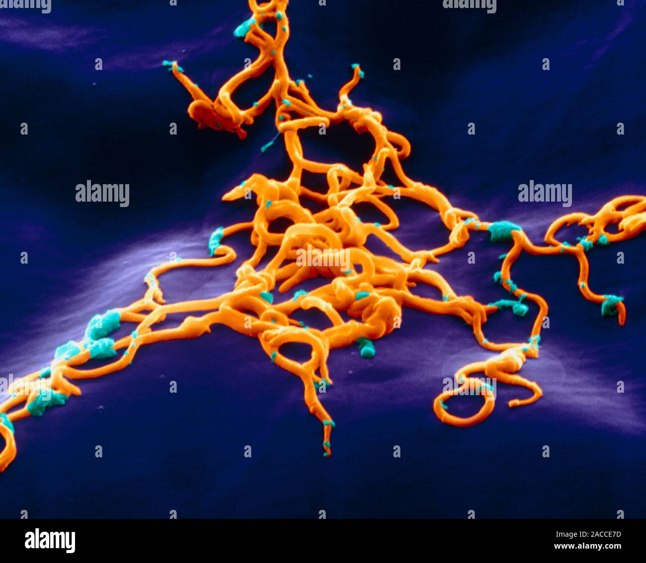 Lyme disease. Coloured scanning electron micrograph of the spirochaete ...