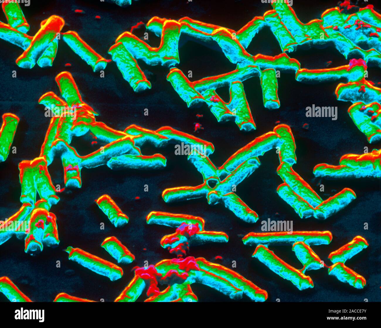 Clostridium perfringens. Coloured Scanning Electron Micrograph (SEM) of ...