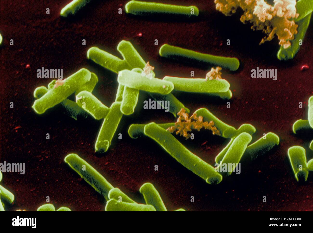 Clostridium tetani. Coloured Scanning Electron Micrograph (SEM) of a ...
