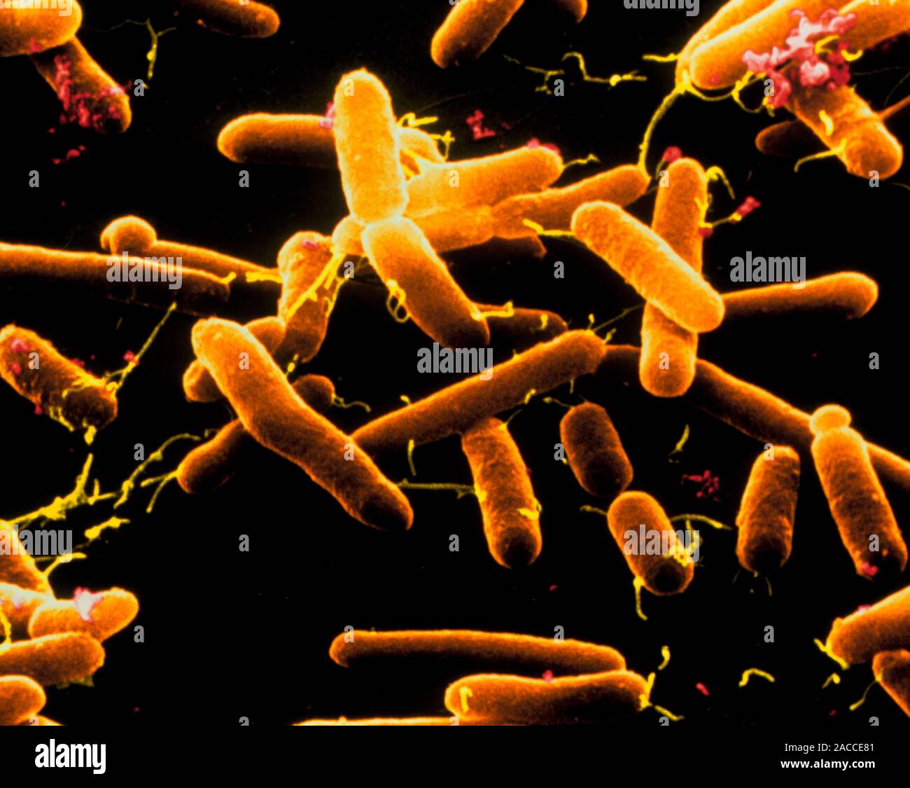Salmonella enteritidis. Coloured Scanning Electron Micrograph (SEM) of ...
