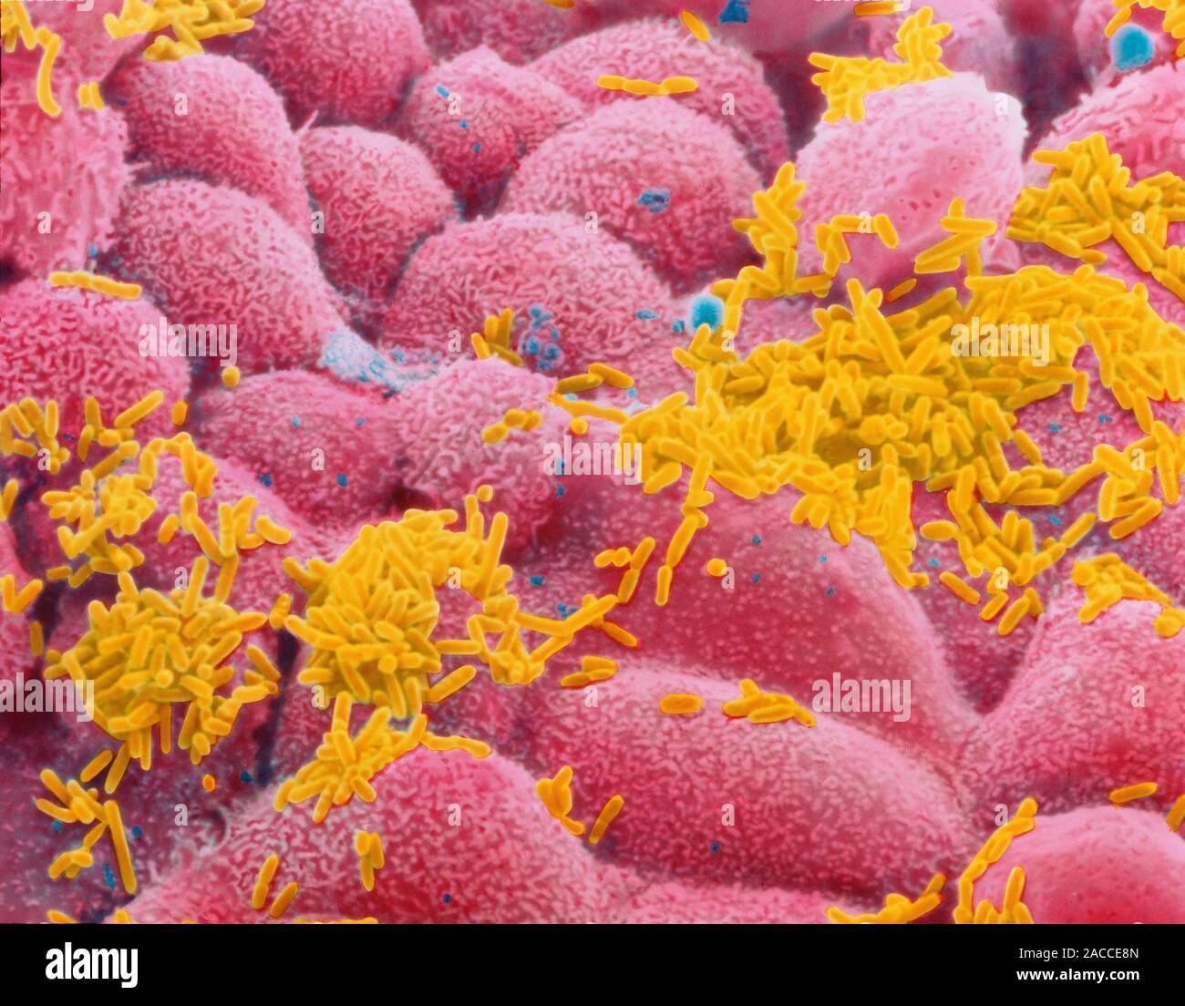 Haemophilus influenzae. Coloured Scanning Electron Micrograph (SEM) of ...