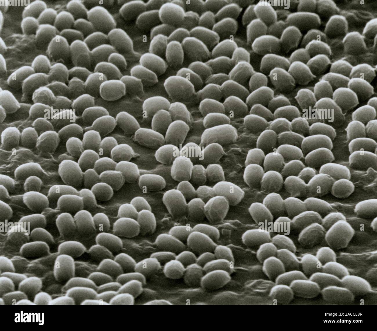 Bacillus anthracis spores. Scanning Electron Micrograph (SEM) of ...