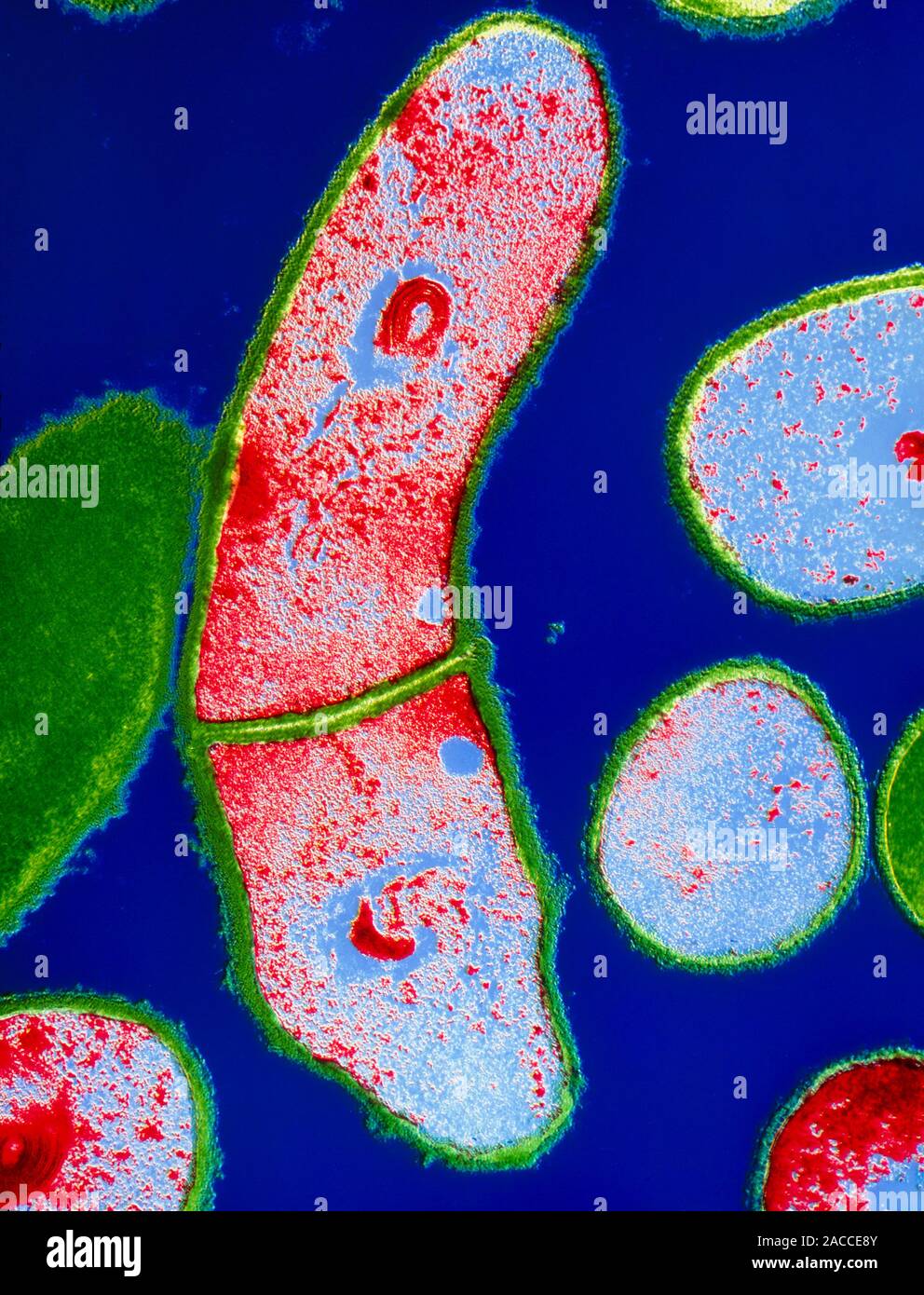 Diphtheria bacteria. Coloured transmission electron micrograph (TEM) of ...