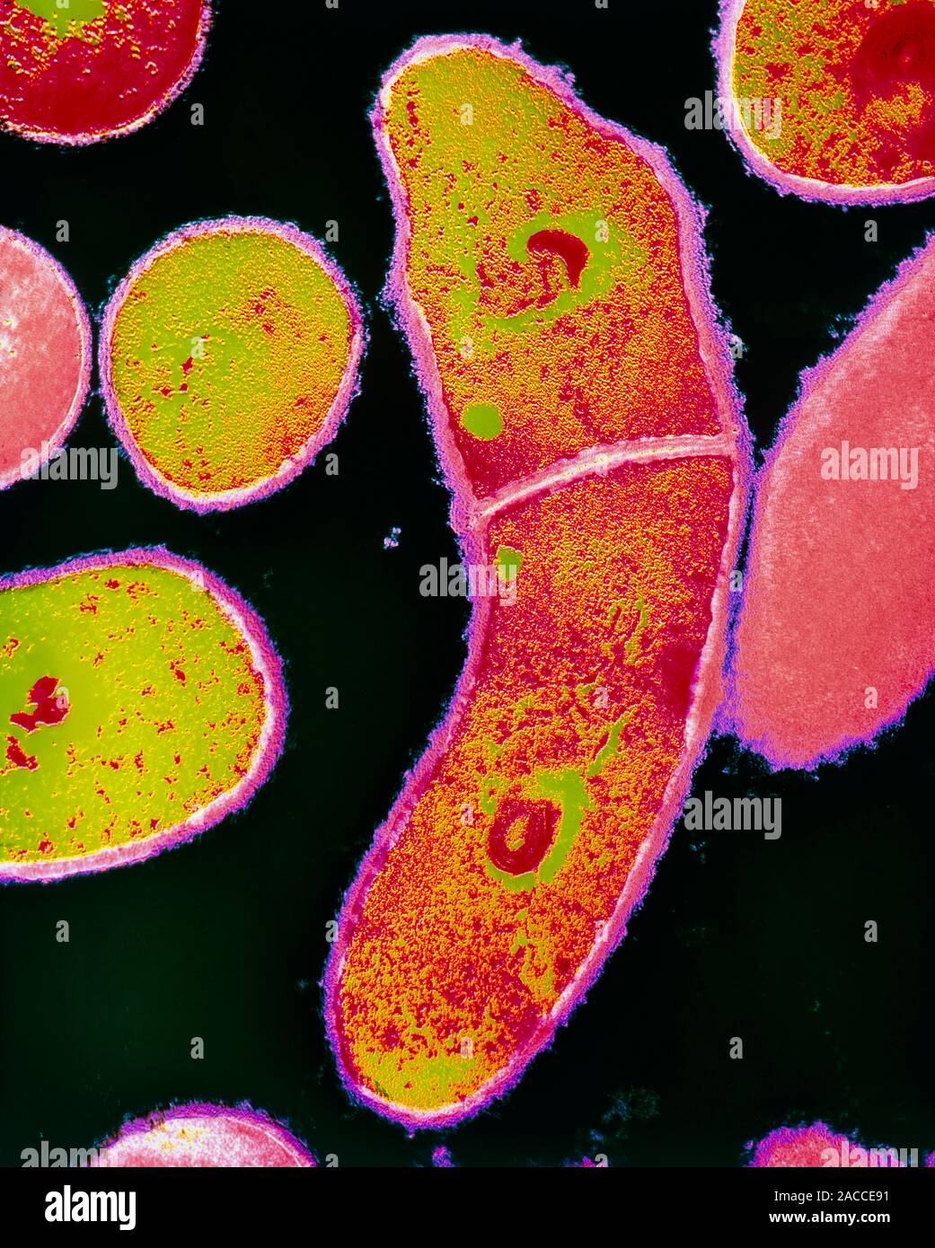 Diphtheria bacteria. Coloured transmission electron micrograph (TEM) of ...
