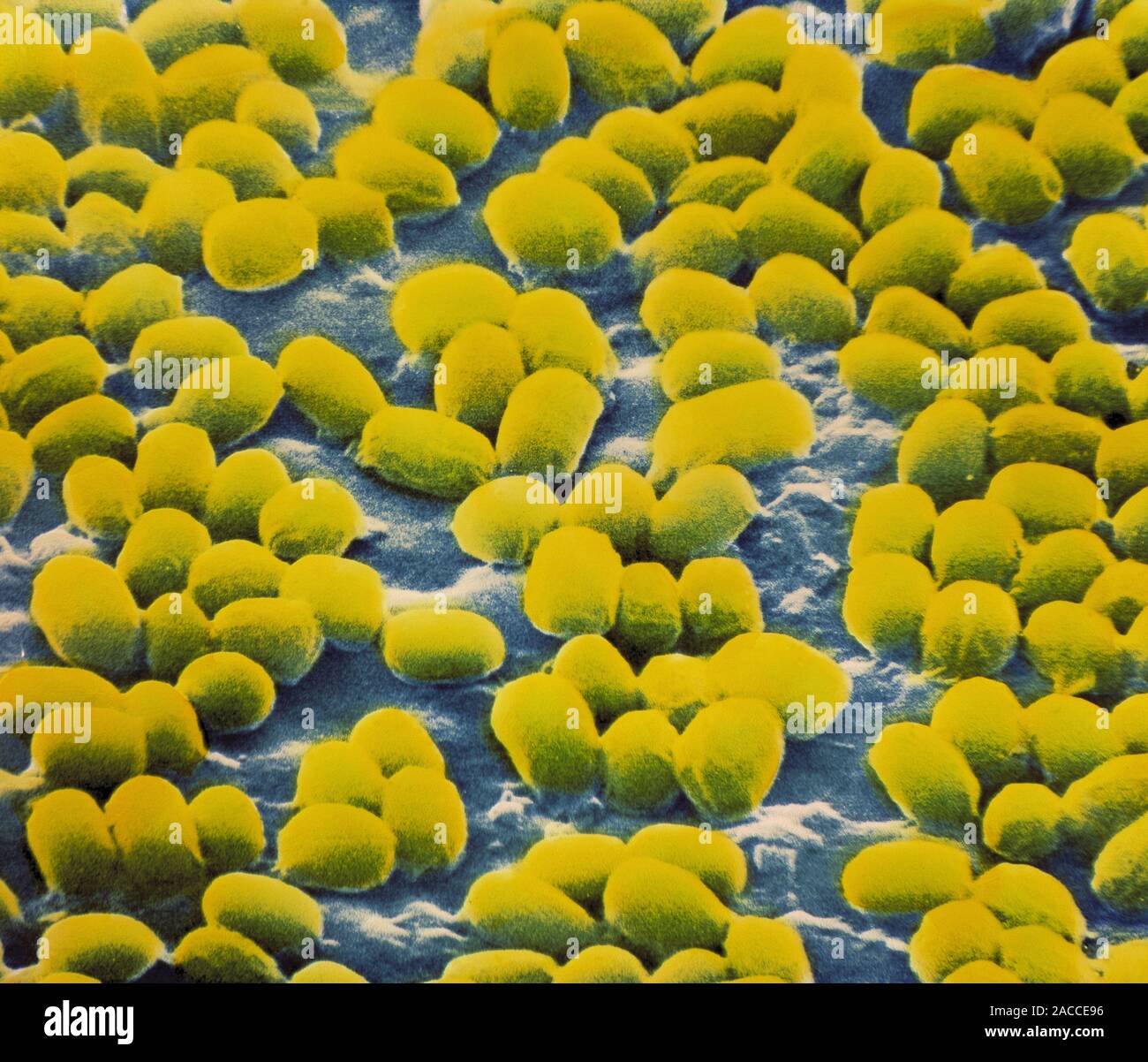 Bacillus anthracis spores. Coloured scanning electron micrograph (SEM ...