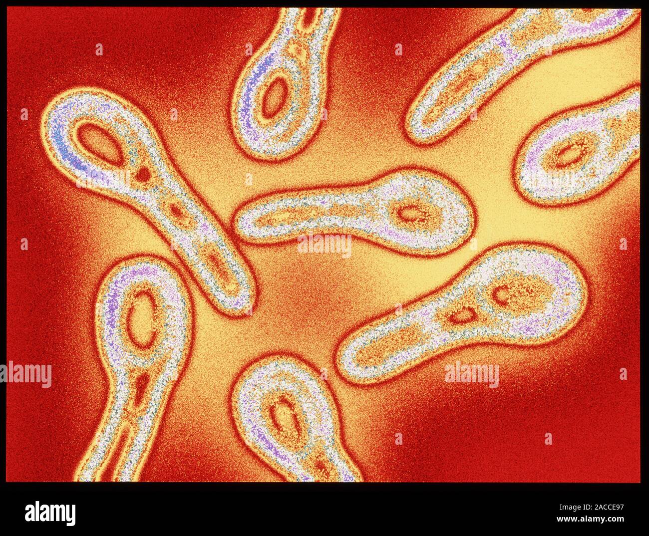 Diphtheria bacteria. Coloured transmission electron micrograph (TEM) of ...