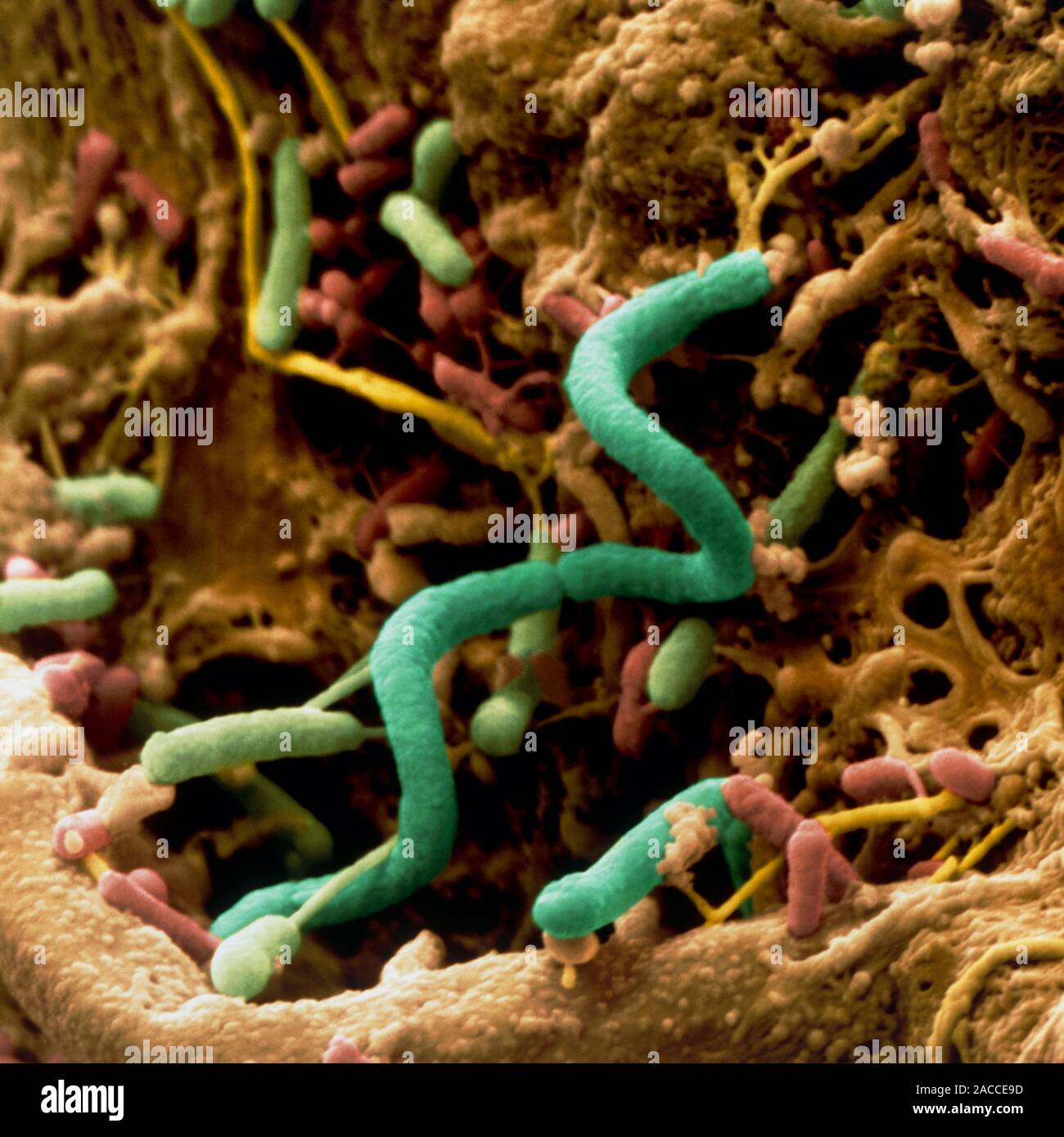Compost heap bacteria. Coloured scanning electron micrograph of a ...