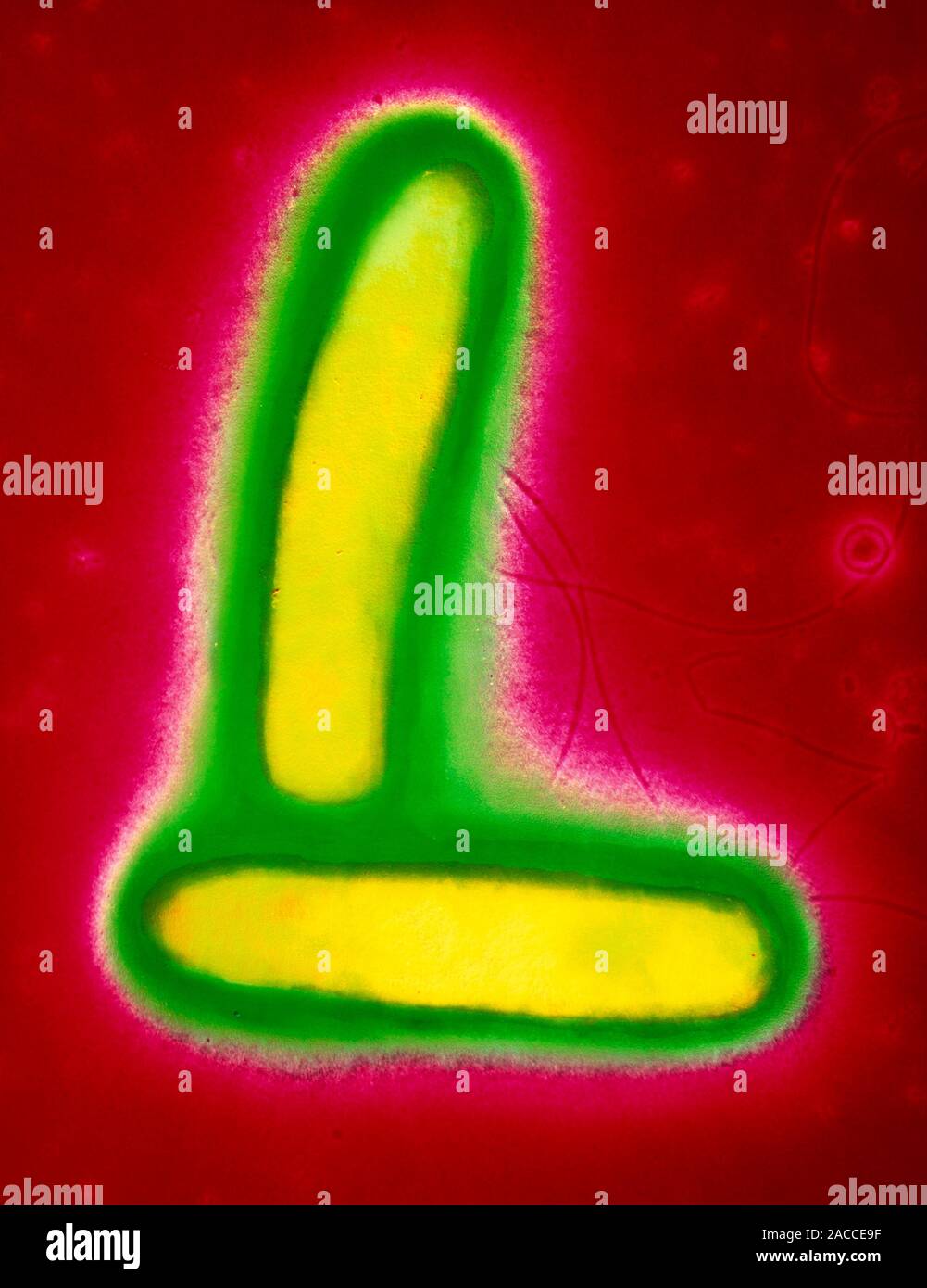 Mycobacterium tuberculosis. Coloured transmission electron micrograph ...