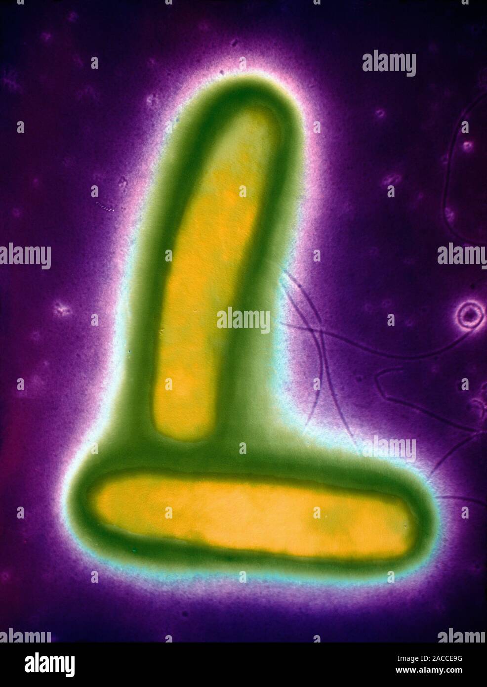Mycobacterium tuberculosis. Coloured transmission electron micrograph ...