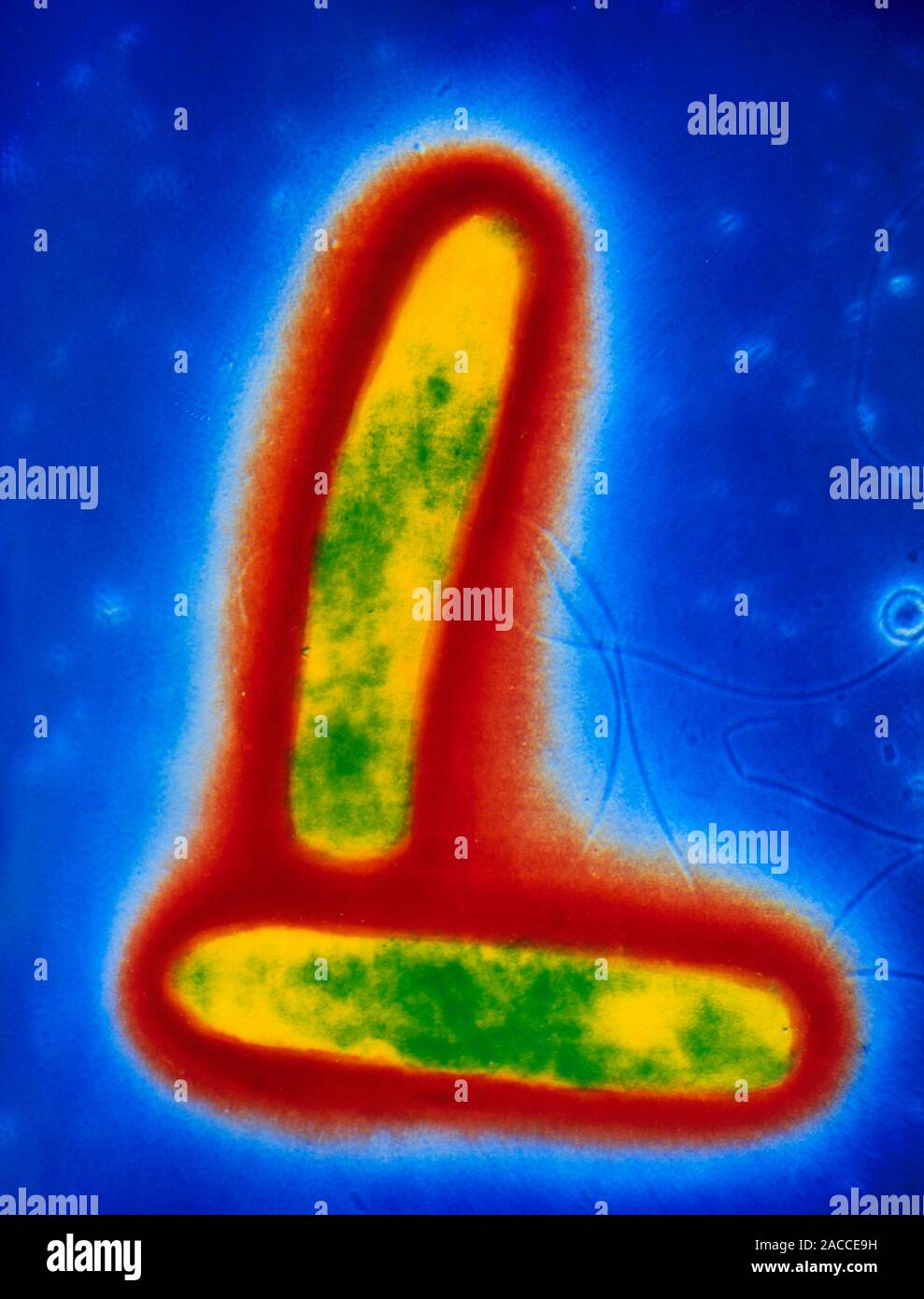 Mycobacterium tuberculosis. Coloured transmission electron micrograph ...