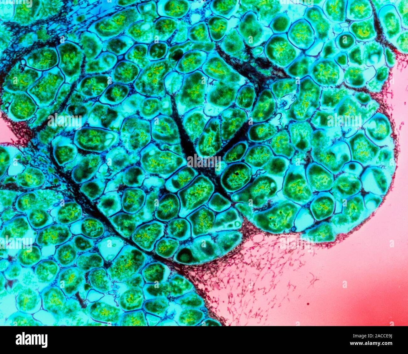 Actinobacillus bacteria. Coloured transmission electron micrograph of ...