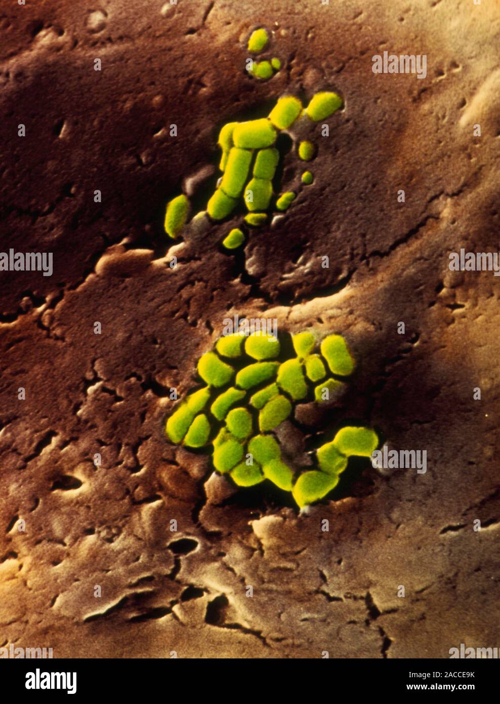 Bacterial contamination of food. Coloured scanning electron micrograph ...