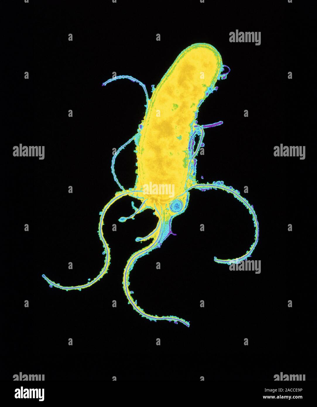 Helicobacter pylori. Coloured transmission electron micrograph (TEM) of a Helicobacter pylori ...