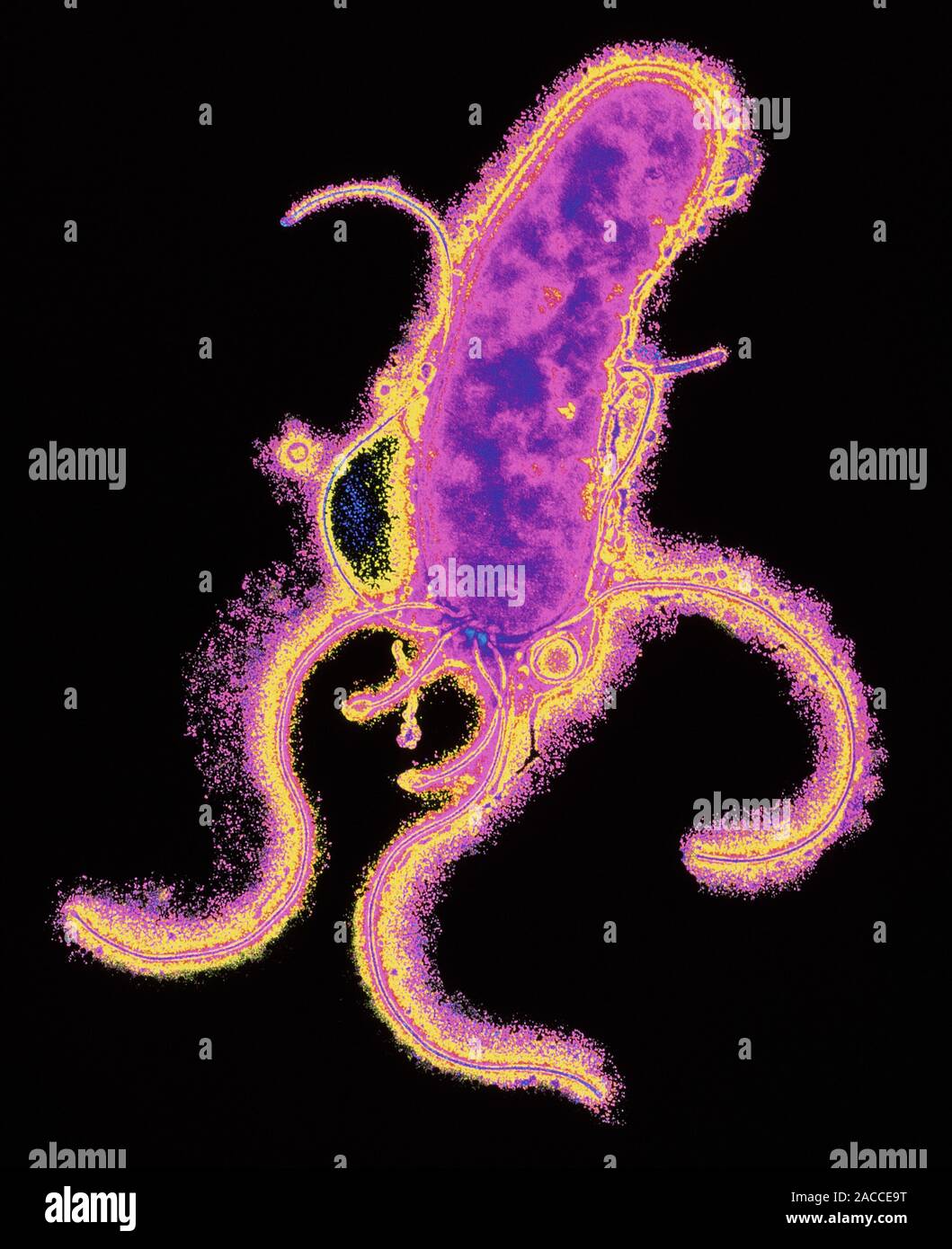 Helicobacter pylori. Coloured transmission electron micrograph (TEM) of a Helicobacter pylori ...